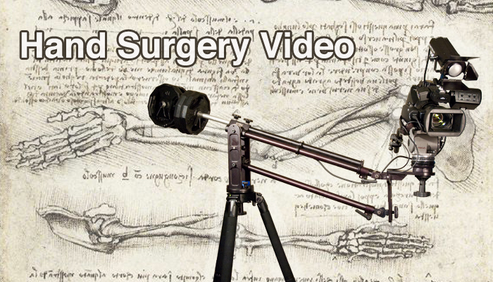 Shooting Hand Surgery Video – Plexus Surgical Video | Plexus Surgical Video